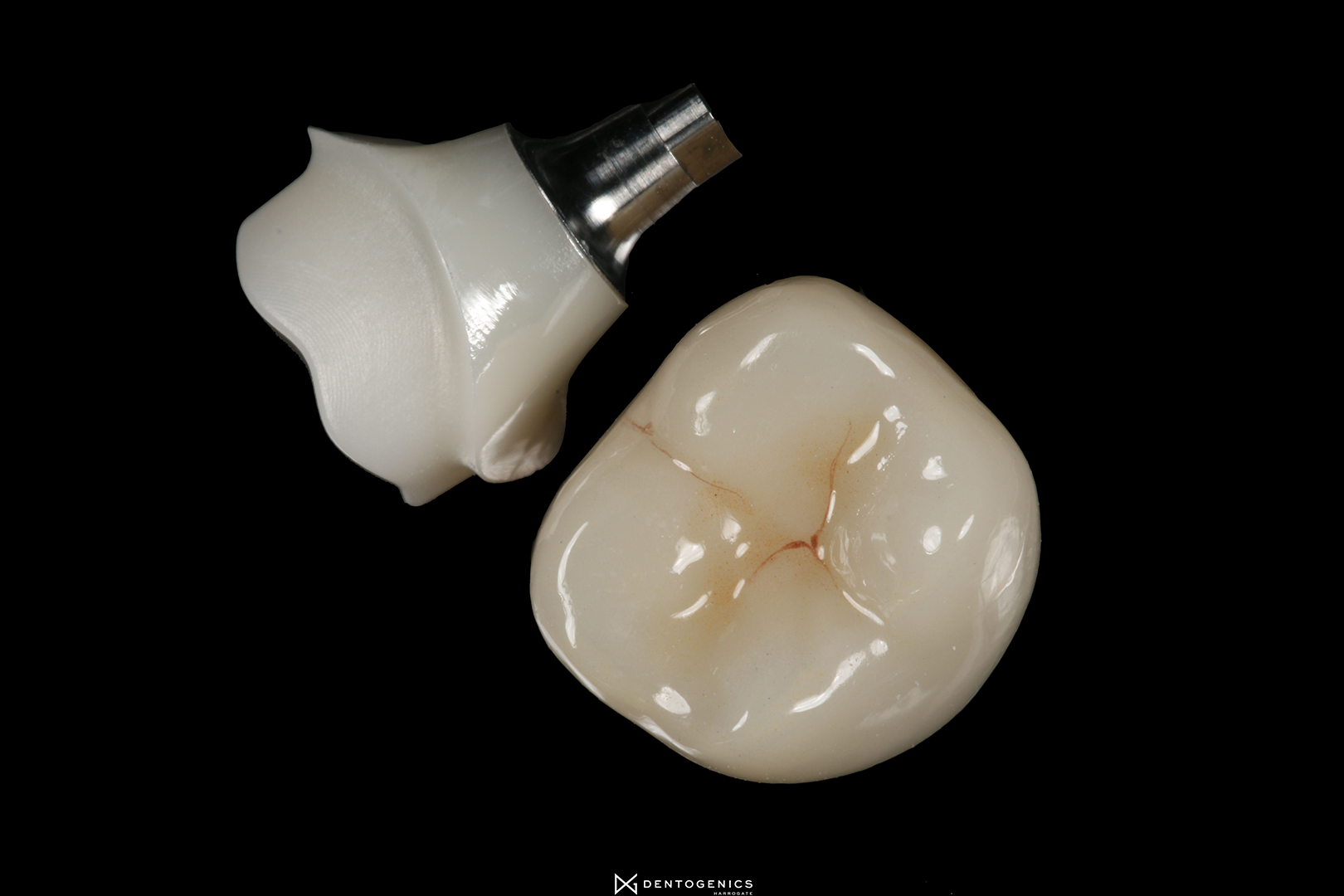 Gallery | Dentogenics