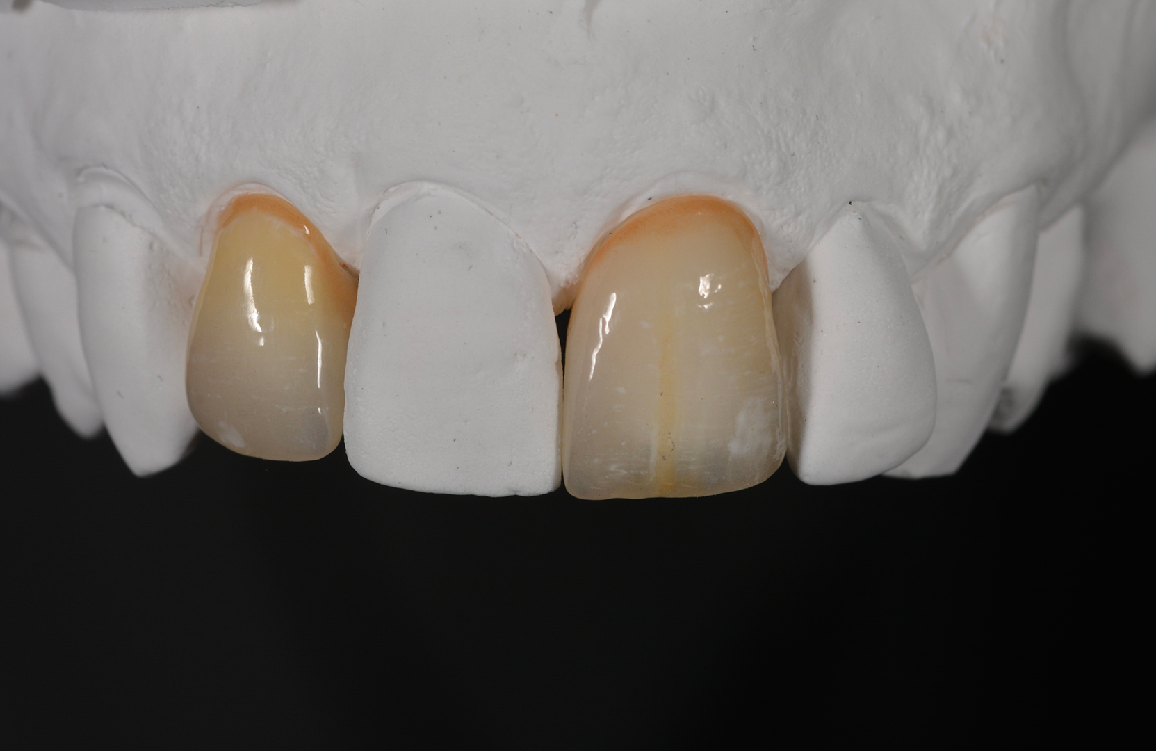 Gallery | Dentogenics