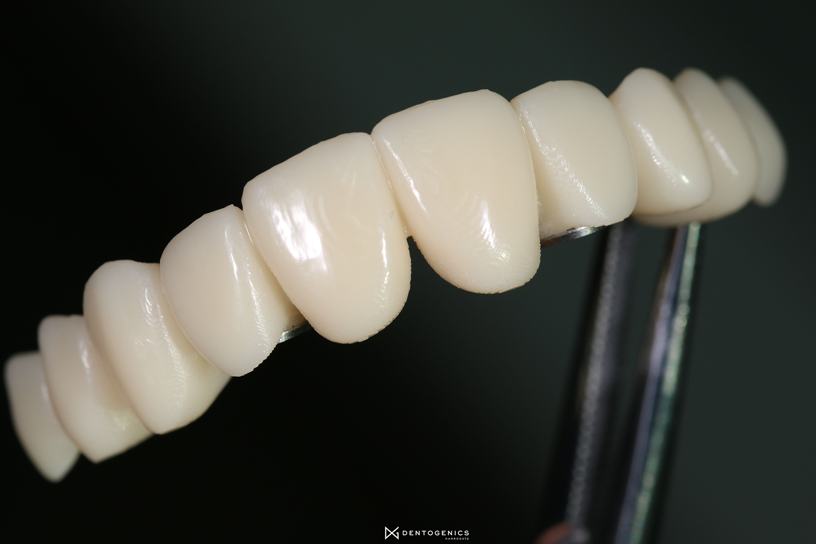 Gallery | Dentogenics